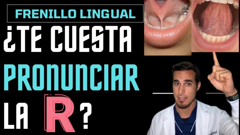 Cirugía para cortar el frenillo de la lengua en adultos: todo lo que ...