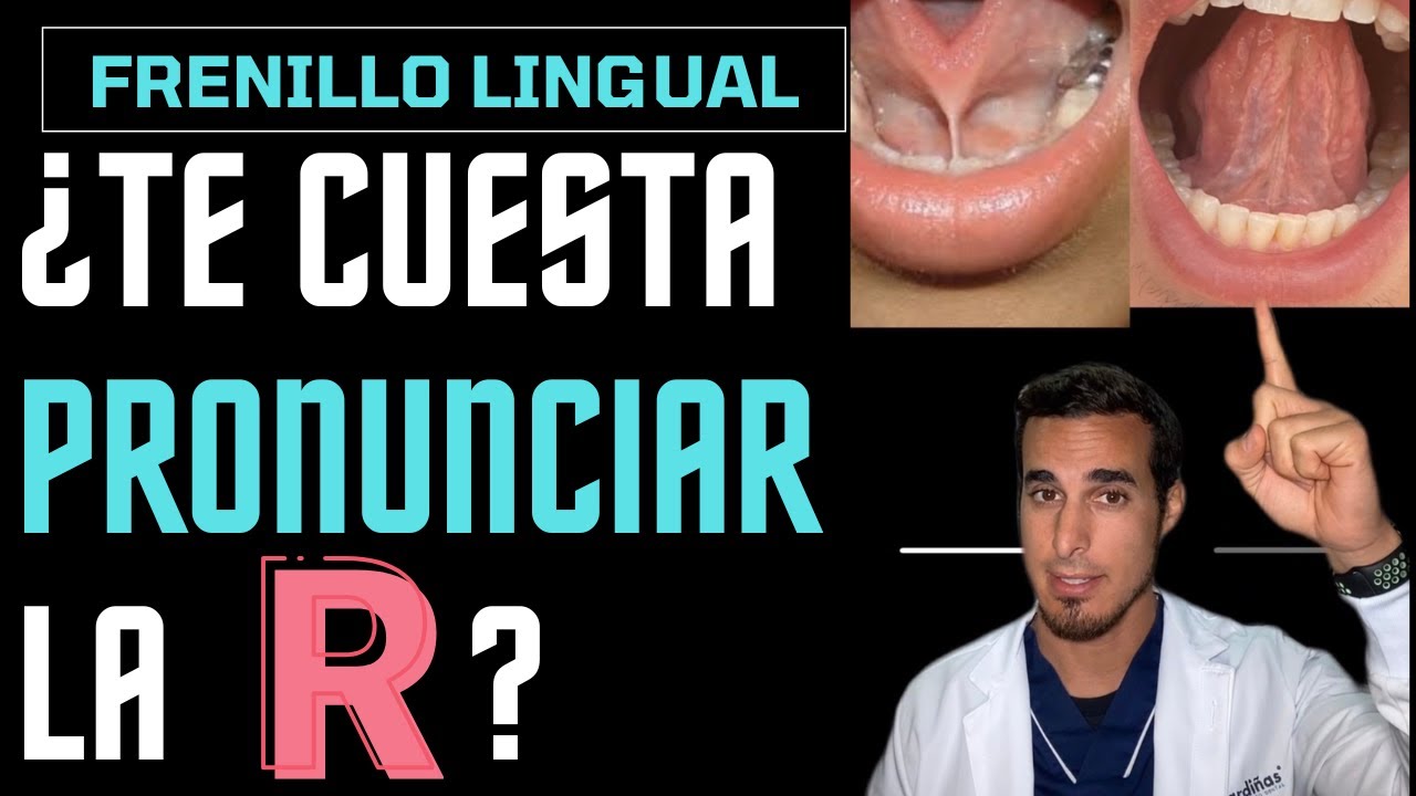 Cirugía para cortar el frenillo de la lengua en adultos: todo lo que ...
